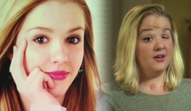 Liz Marks, the story of a victim of SMS while driving | The Ultimate ...