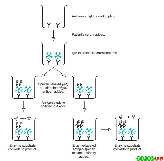 [Microbiology] Atlas about Immunodiagnosis of Infectious Diseases ...