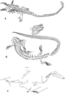 opisthotonus - USA News Collections
