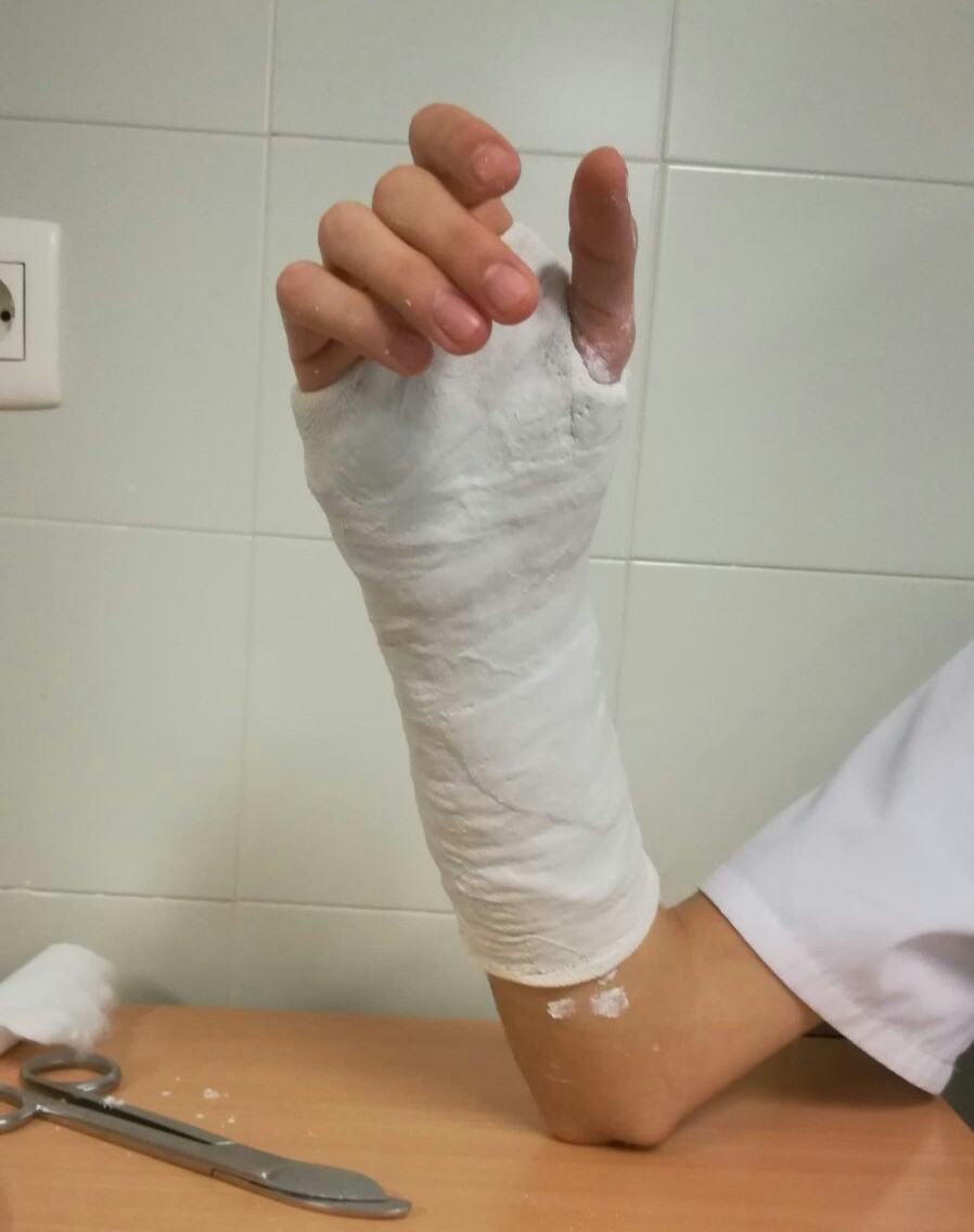 Aplicación de vendaje enyesado antebraquial