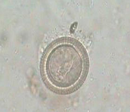 Parasites online