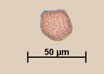 Geography, Geology & Environment at the University of Hull: Palynology ...