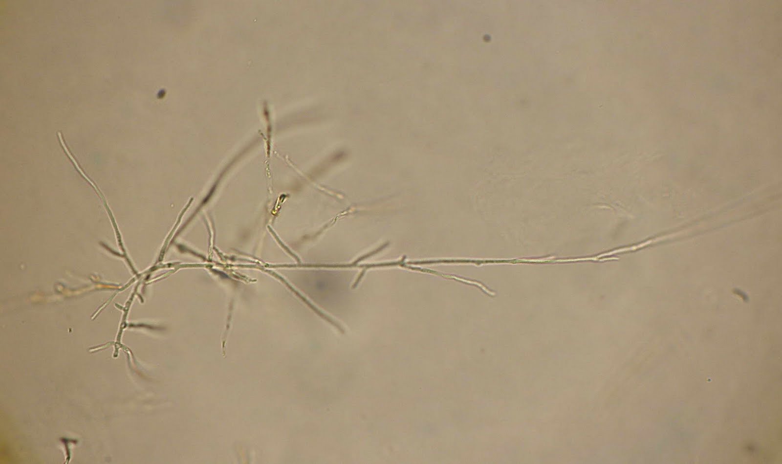 ATLAS MICOLOGIA: TRICHOPHYTON SOUDANENSE