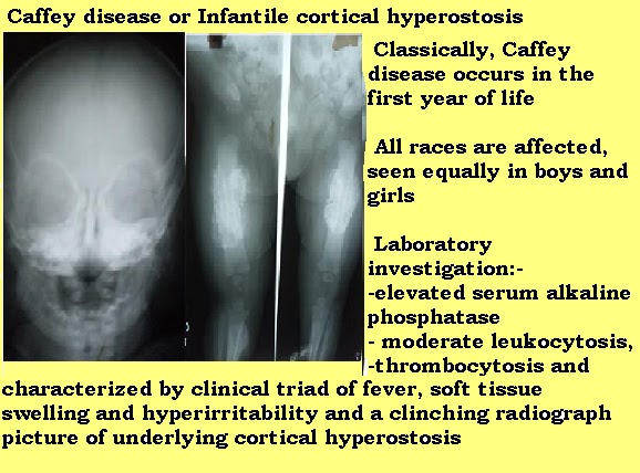 DENTAL AIPG MOST ASKED TOPICS: caffey disease