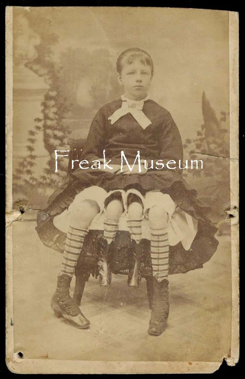 Freak Museum A Private Collection: Freak Photos 19th c.