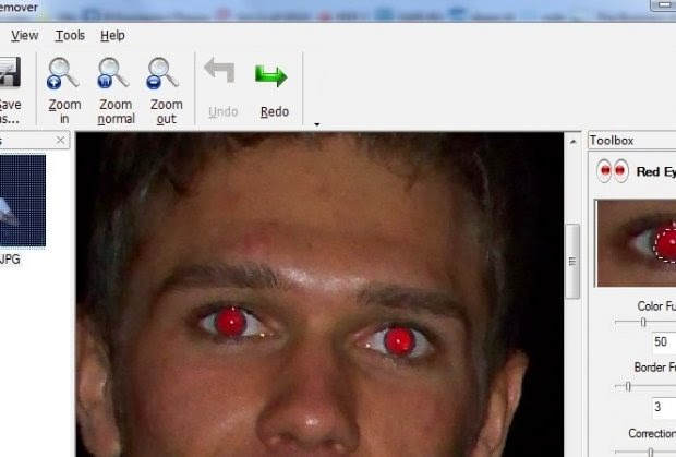 NEMOJTE SE ŠALITI, OVO JE VEOMA OZBILJNO: Ako vam je samo jedno oko ...