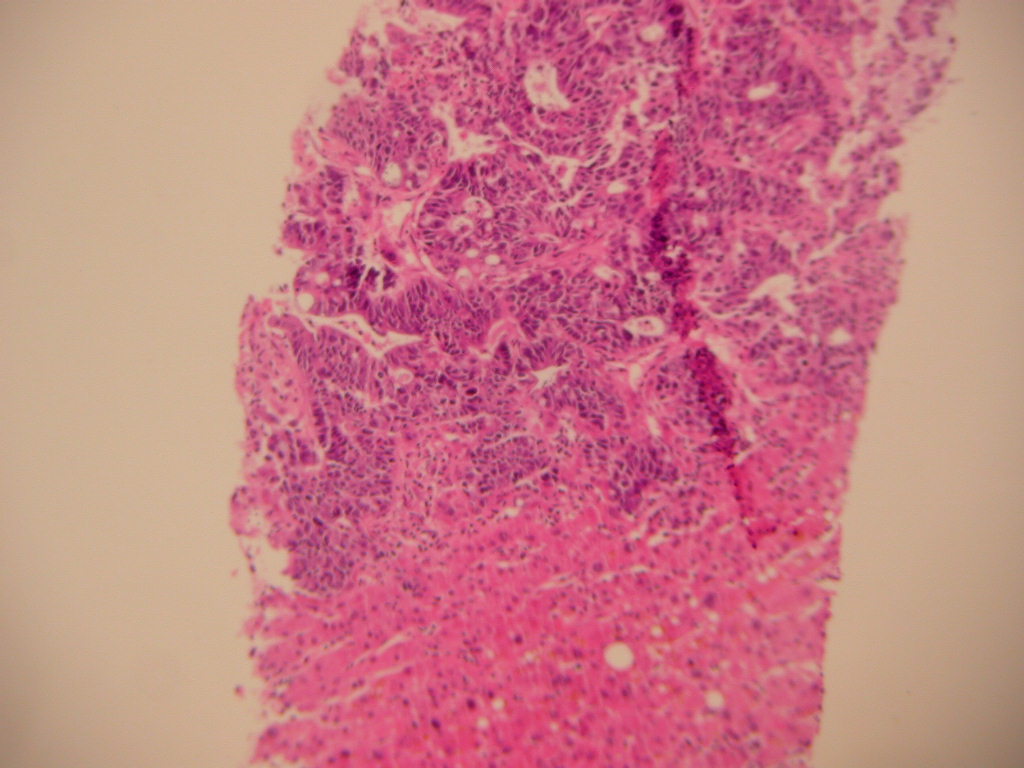 Histopathology Lessons, Research And Resources: Progress In The ...