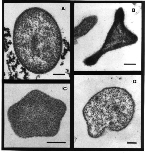 Say Hi to "Methanogens in human flora"