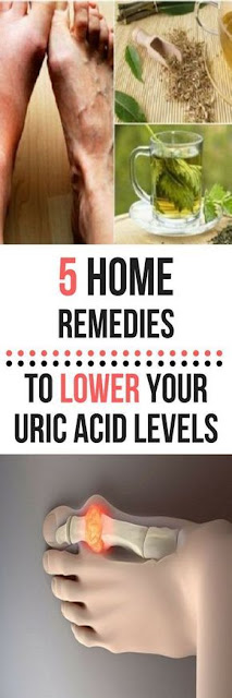 5 HOME REMEDIES TO LOWER YOUR URIC ACID LEVELS - Fitness Fiesta