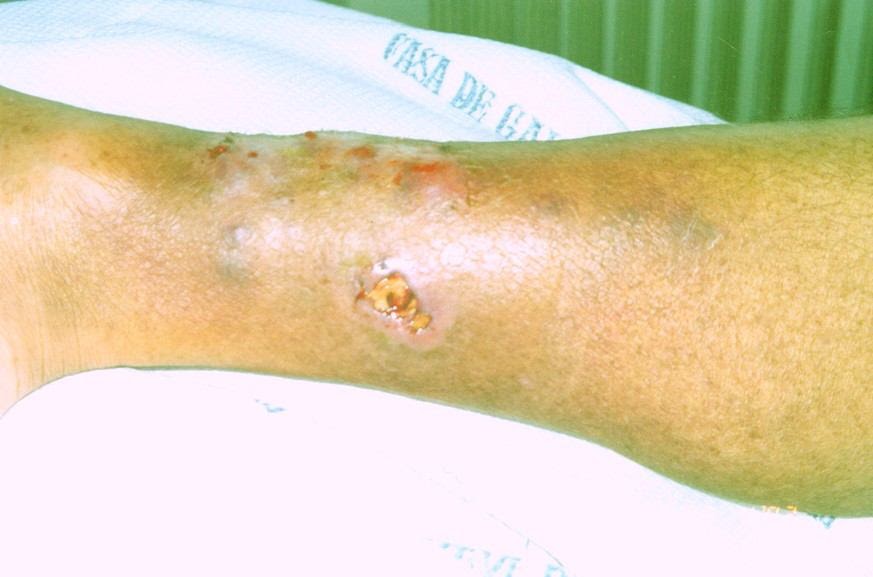 EL PELIGRO DE LA ARAÑA LOXOSCELES - Fumigaciones PROPARK