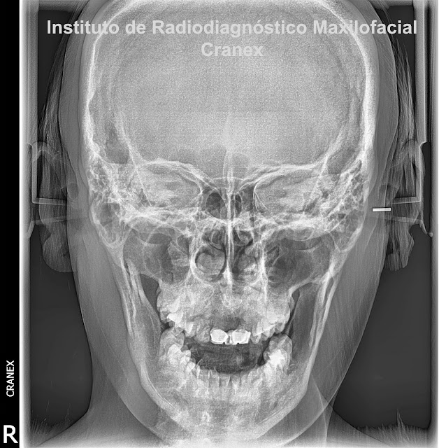 .cranex: diciembre 2015