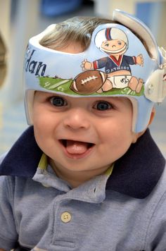 Technology and Inovation: Cranial Technologies Helmet