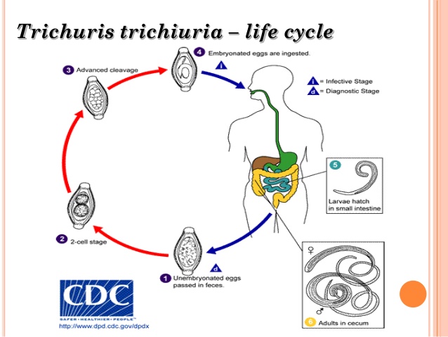 Lecture Notes in Medical Technology: Lecture #2: THE INTESTINAL NEMATODES