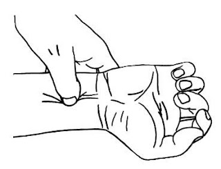 Titik Akupunktur untuk Insomnia - Tips Kesehatan Wanita