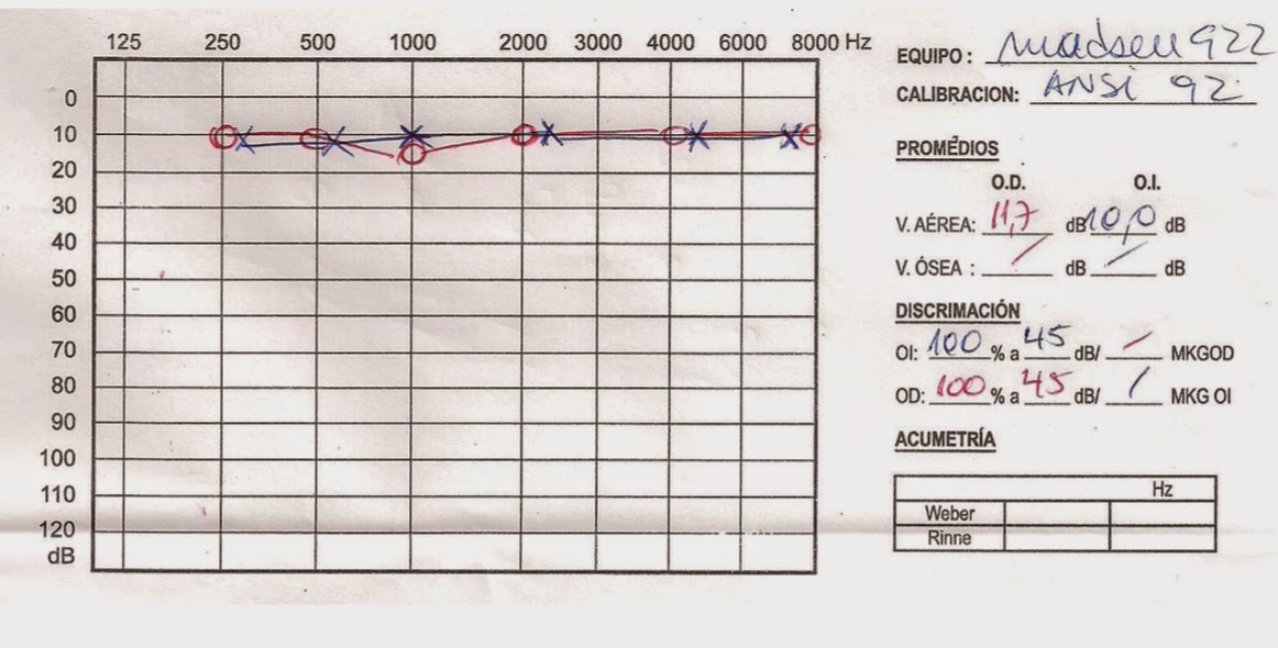 Audiología para Estudiantes: enero 2015