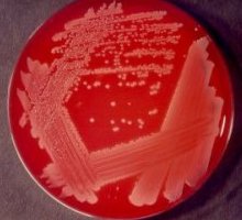 analis kesehatan l indah dwi oktaviani: Vibrio sp