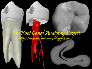 The Root Canal Anatomy Project: C-Shaped Mandibular Premolar