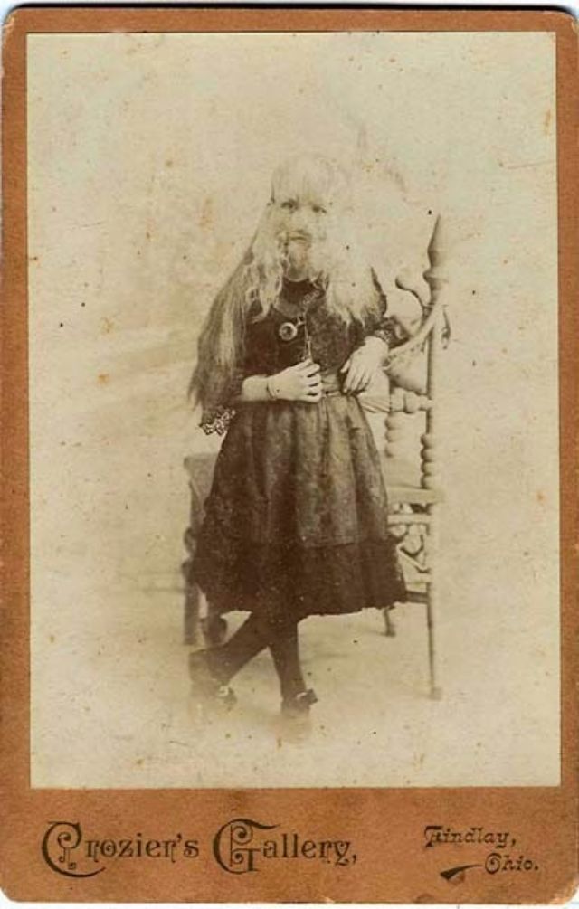 Amazing Vintage Photographs of the 'Minnesota Woolly Girl' Alice ...