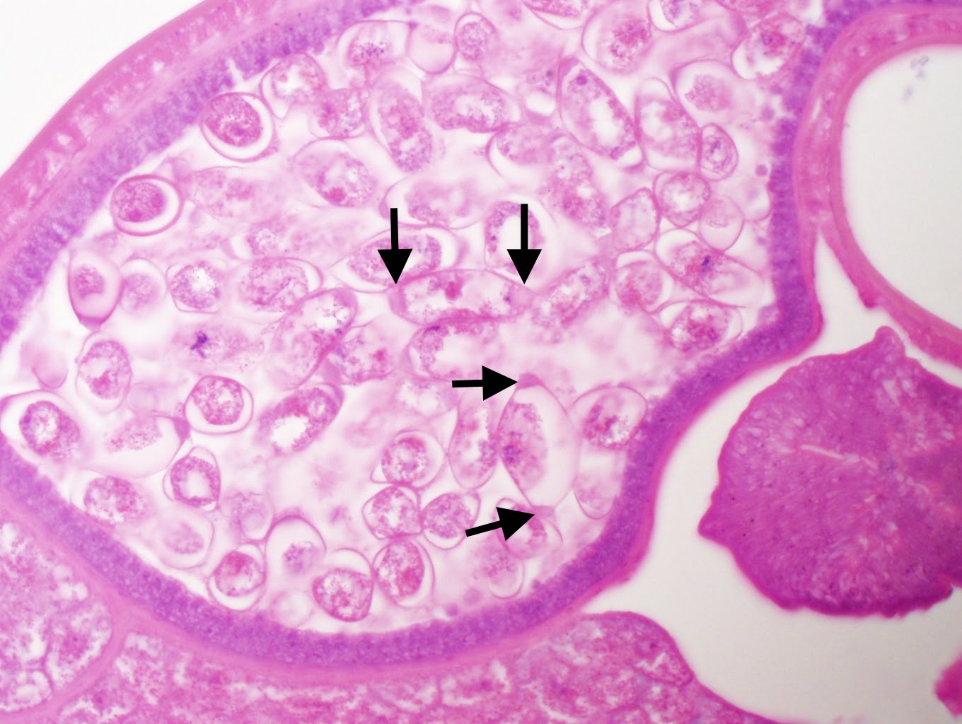 Creepy Dreadful Wonderful Parasites: October 2011