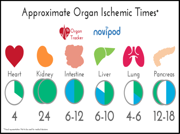 Skilled Analysts Blog: How IoT helps transplant surgeons track organ ...