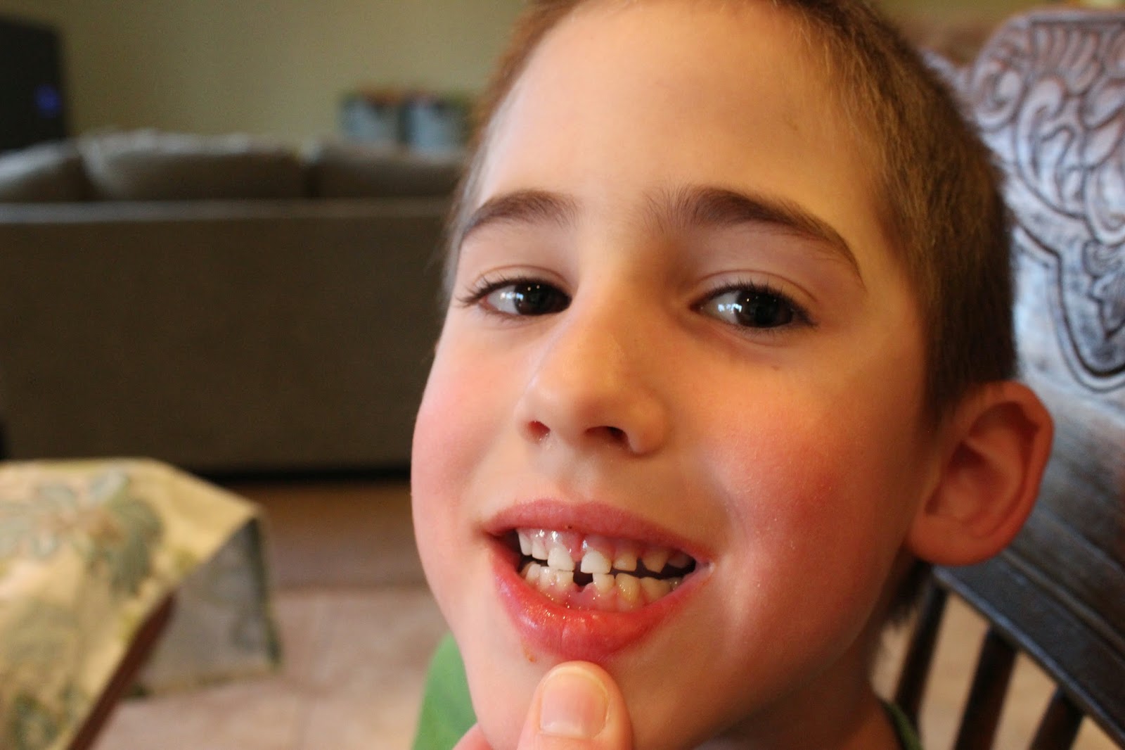 Together, we make a family.: James lost his first tooth!