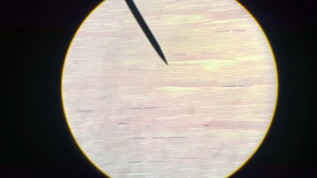 Histología: Tendón