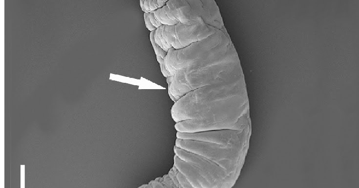 the curiosity payoff: from spiny-headed worms to swellable microneedle ...