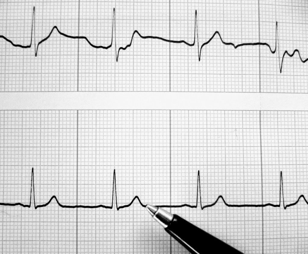 Internal Medicine Pharmacotherapy: Use of sodium polystyrene sulfonate ...
