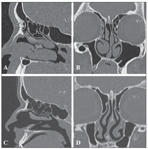 Auger Gear Image: Agger Nasi Cell Types
