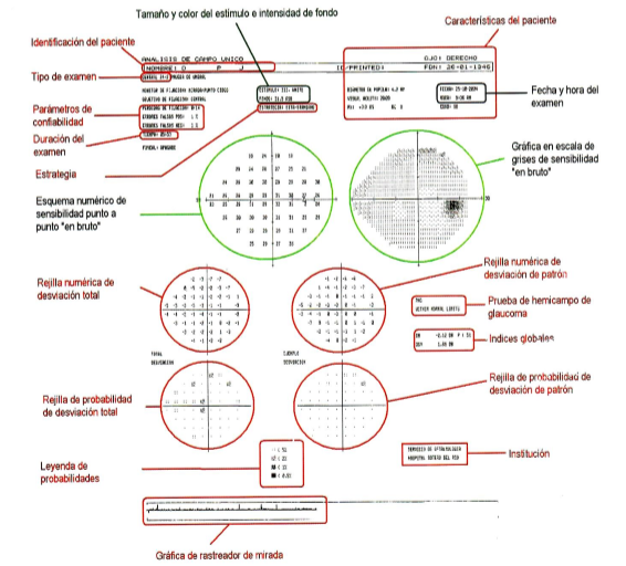 Interpretación Campo visual