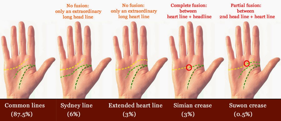 ประเภทของเส้น - Onlinepalmistry