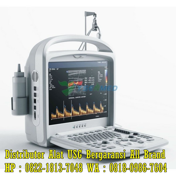 Science Archive: Distributor Alat USG Mindray dan Weld