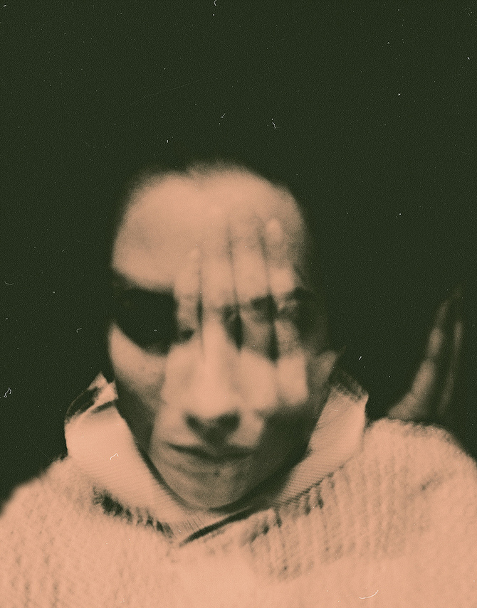 Jone Reed. Fotografía | Doctor Ojiplático