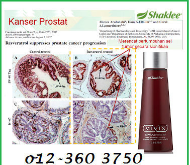 Tanda-Tanda Bengkak Prostat Di Kalangan Lelaki Awal 30' an ~ Pengedar ...