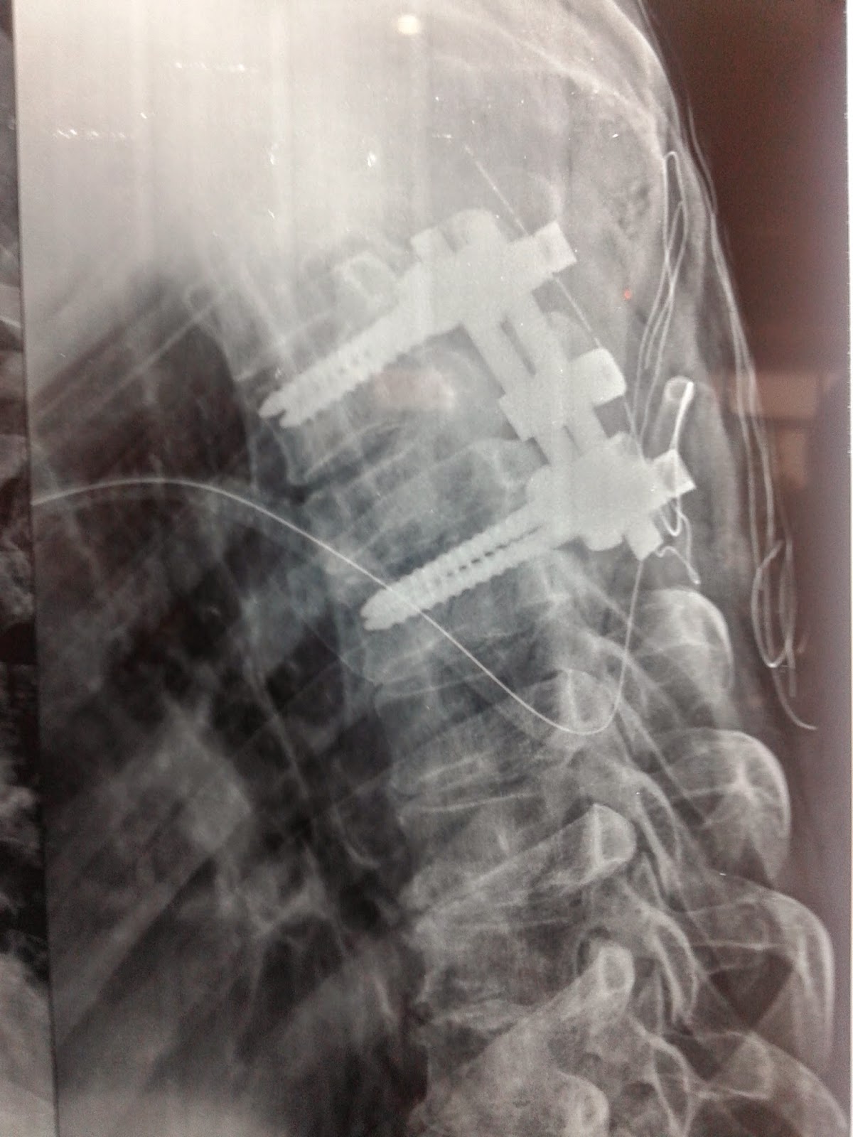 NEUROSURGEON SPINE SURGEON SKULL BASE NEUROSURGEON in Punjab ...