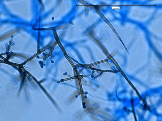 Fun With Microbiology (What's Buggin' You?): UnIdentified Black Mould