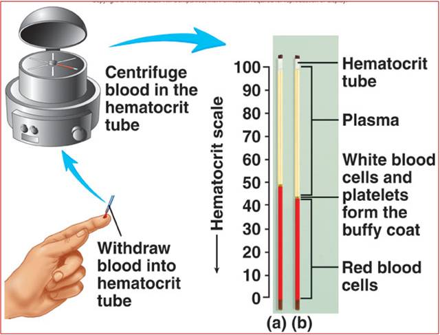 Pemeriksaan Hematokrit (Metode Mikrohematokrit) | Seri Edukasi ...