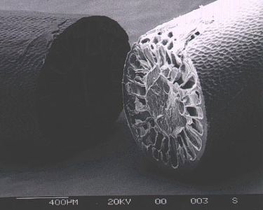 Hedgehog: Physical description