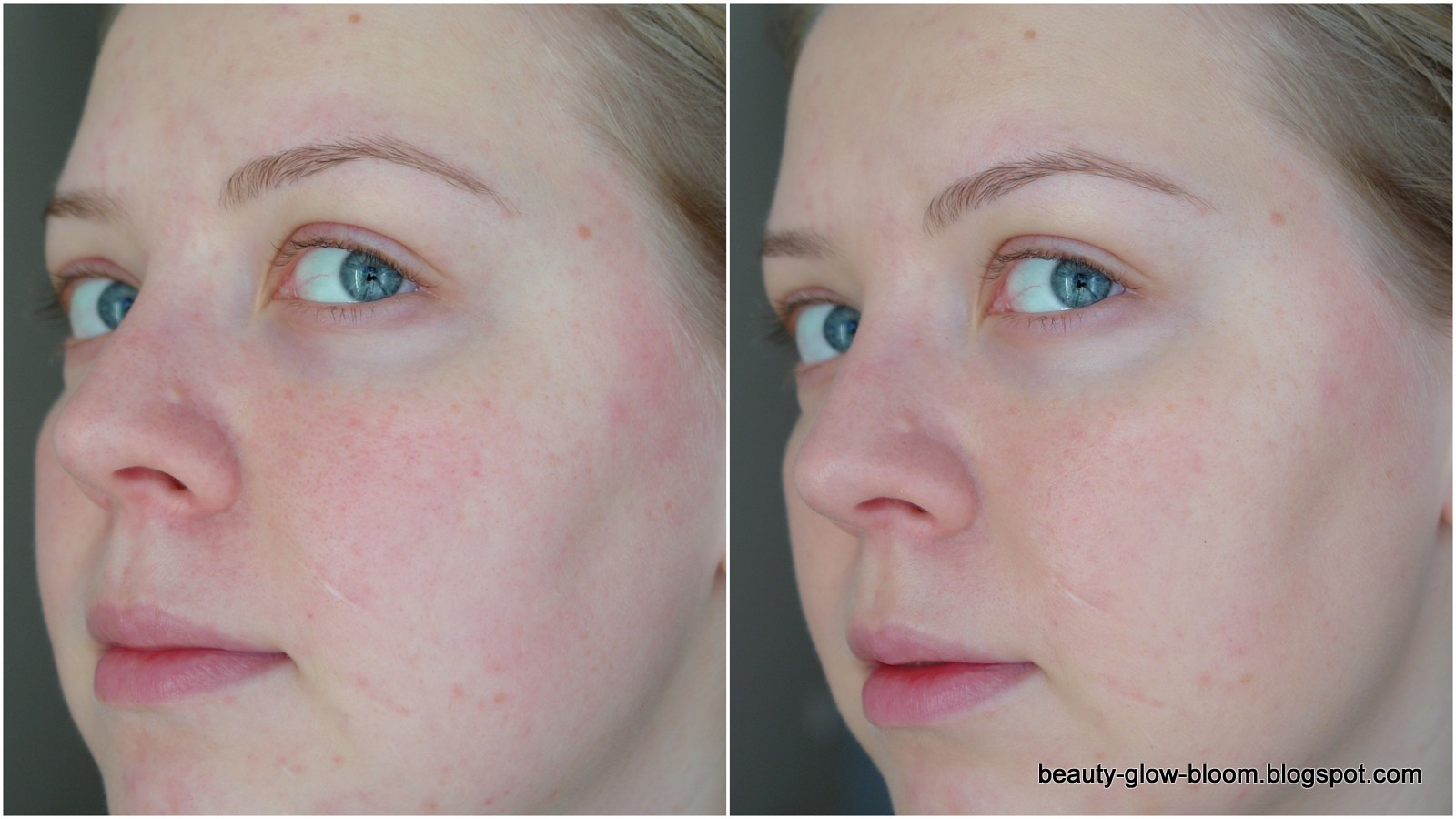 EVA Mosaic BB Blemish Balm Perfect Care&Cover SPF30 - Медовый - beauty ...