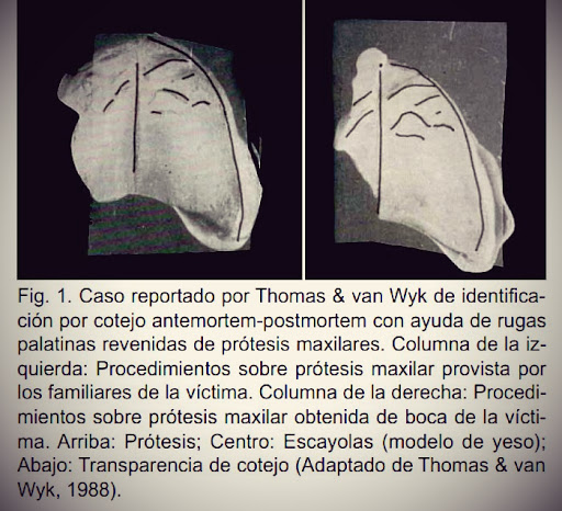 PDF: Odontología Forense: Rugas Palatinas y Huellas Labiales en ...