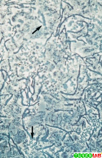 [Parasitology] Atlas of Medically Significant Fungi | Free Medical Atlas