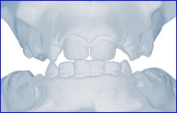 APARATOLOGIA ORTOPEDICA: FRANKEL IB