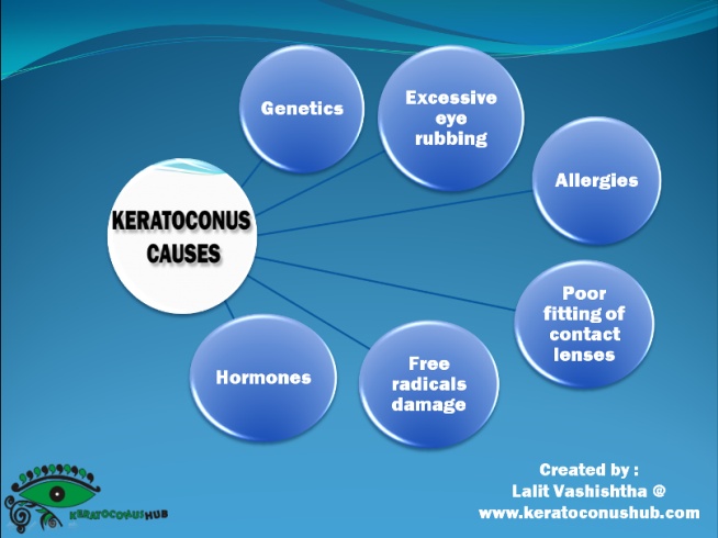 Keratoconushub: HOME PAGE