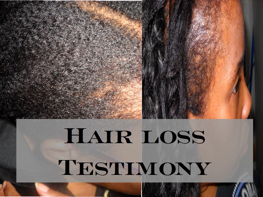 CoilyQueens™ : Hair loss testimony