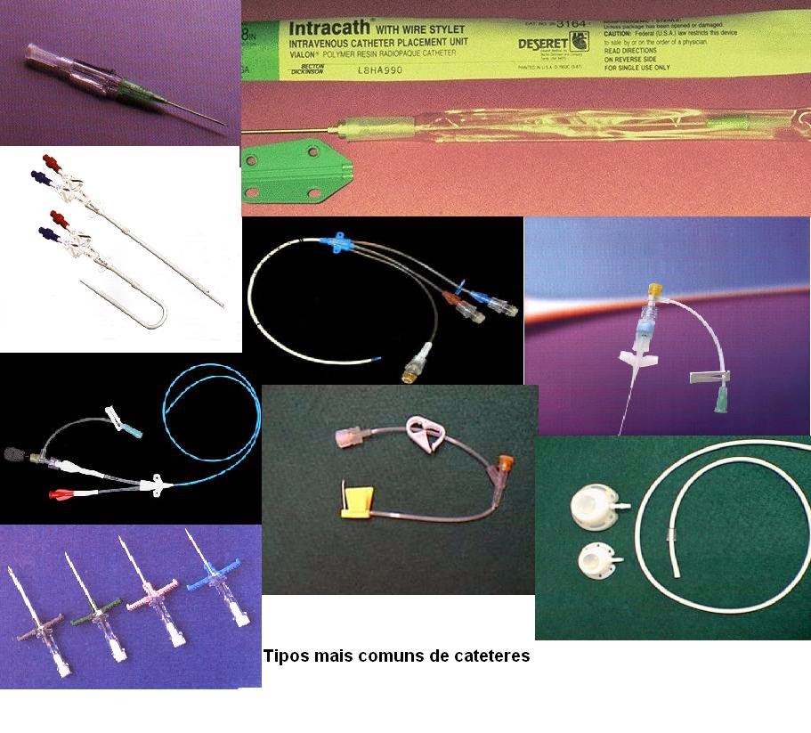 Enfermagem online - blog da enfermagem: Fevereiro 2012