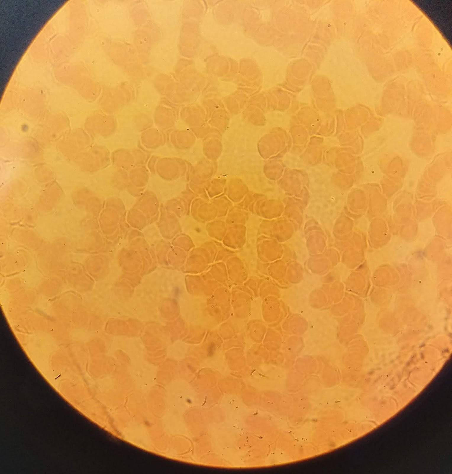 Práctica 7: Examen en fresco de sangre al microscopio.