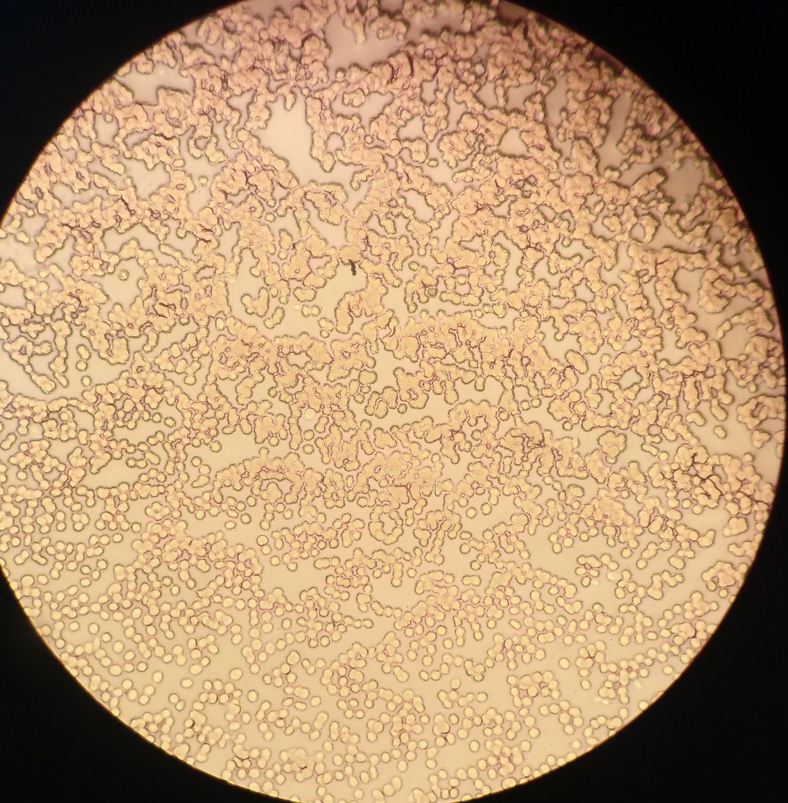 Práctica 7: Examen en fresco de sangre al microscopio.