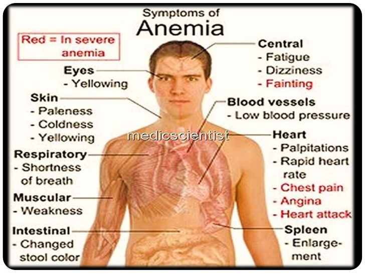 Klinik Medilove Kepong: Iron Deficiency Anemia