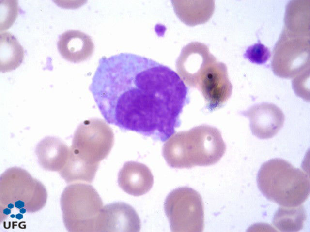 Hematología Fichas: Promonocito