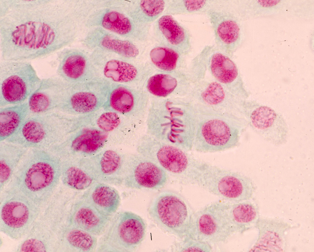 Laboratorio de Biología: MITOSIS EN MERISTEMAS VEGETAL